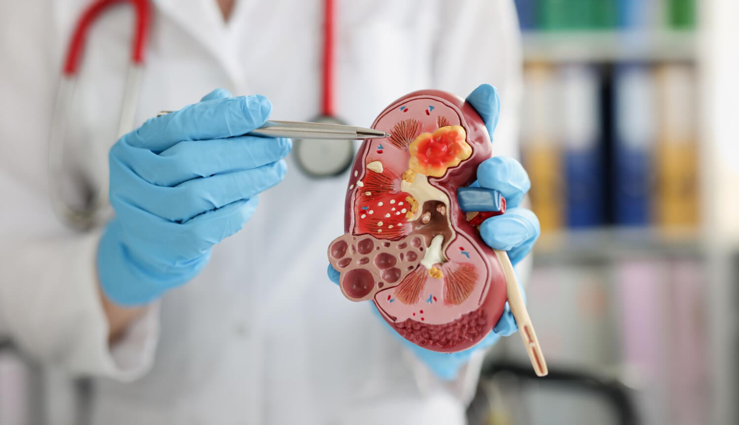 Urology Archives - IRIS Hospital | Multi Speciality Hospital in Anand